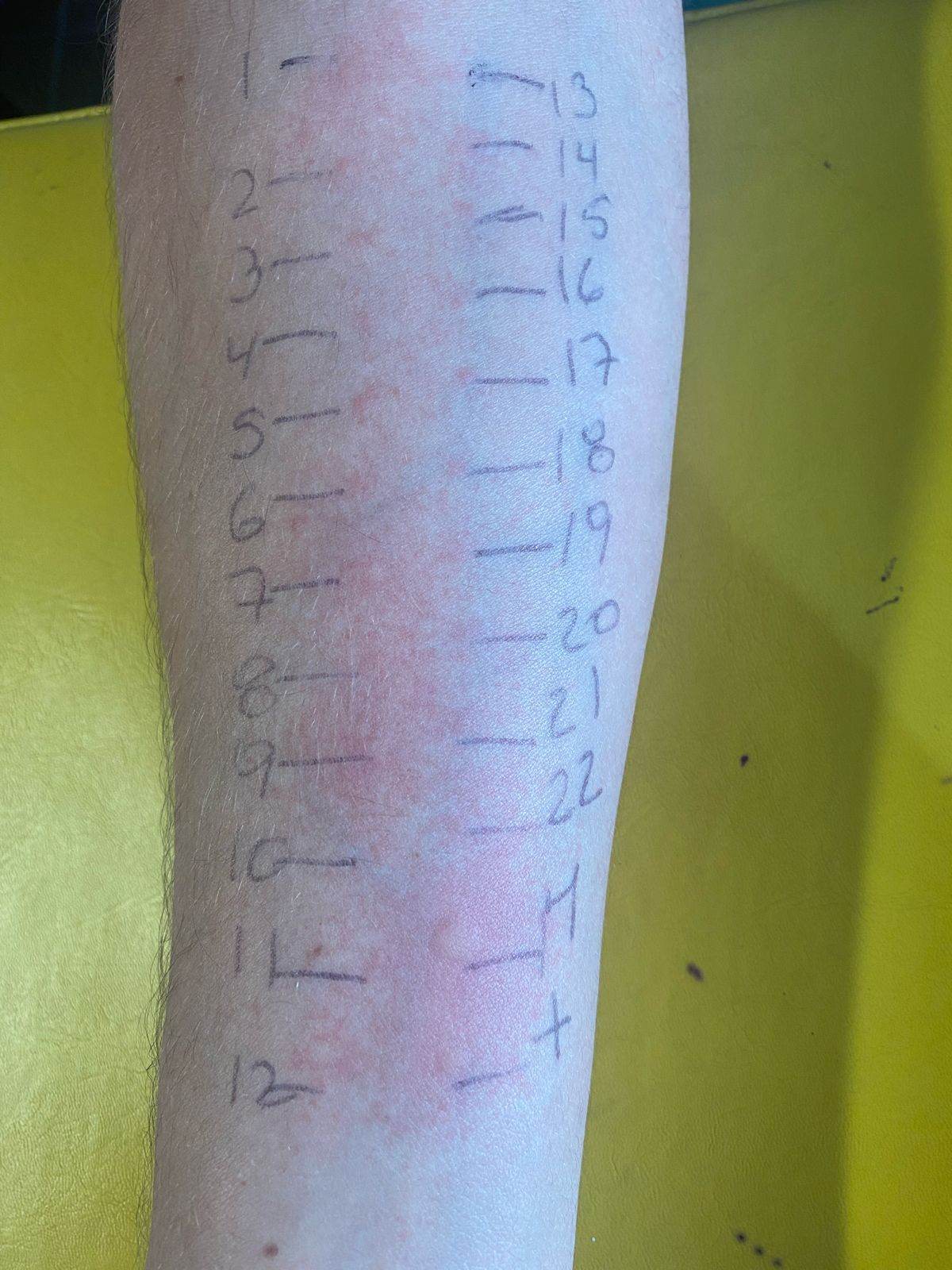 Pruebas Cutáneas – Allergoped